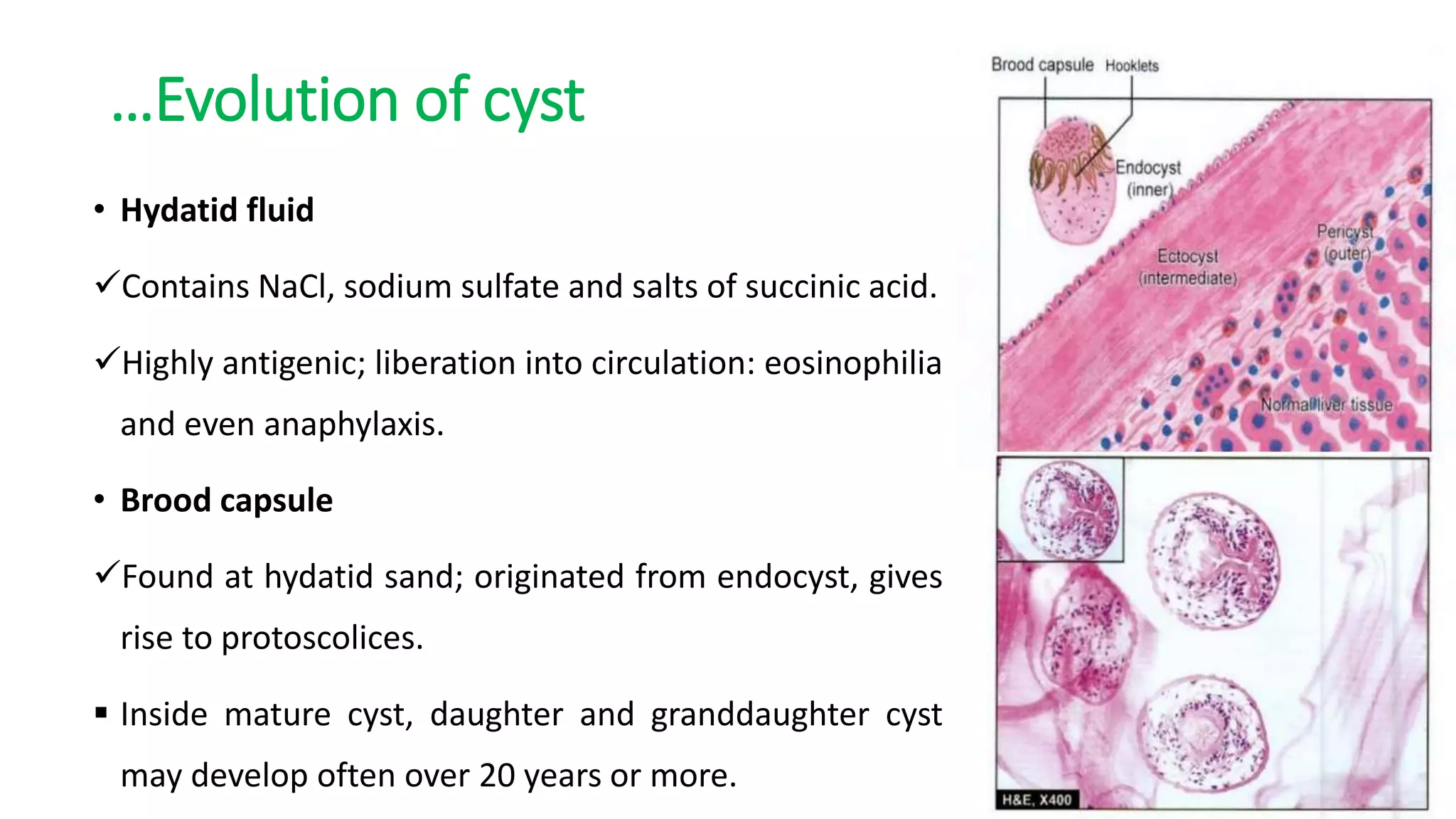 Hydatid Cyst Ppt