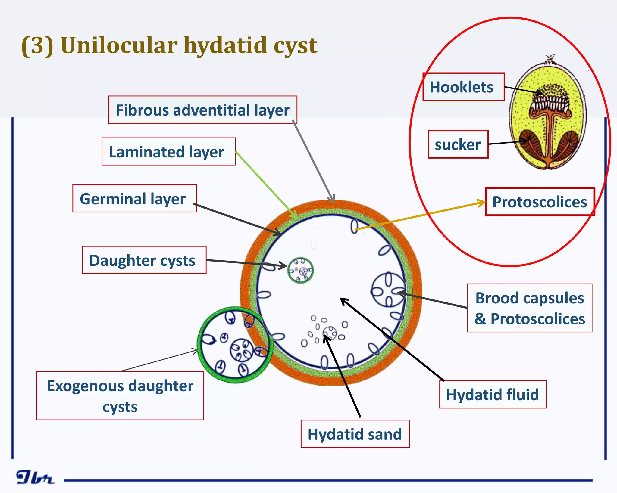 Hydatid cyst.pptx