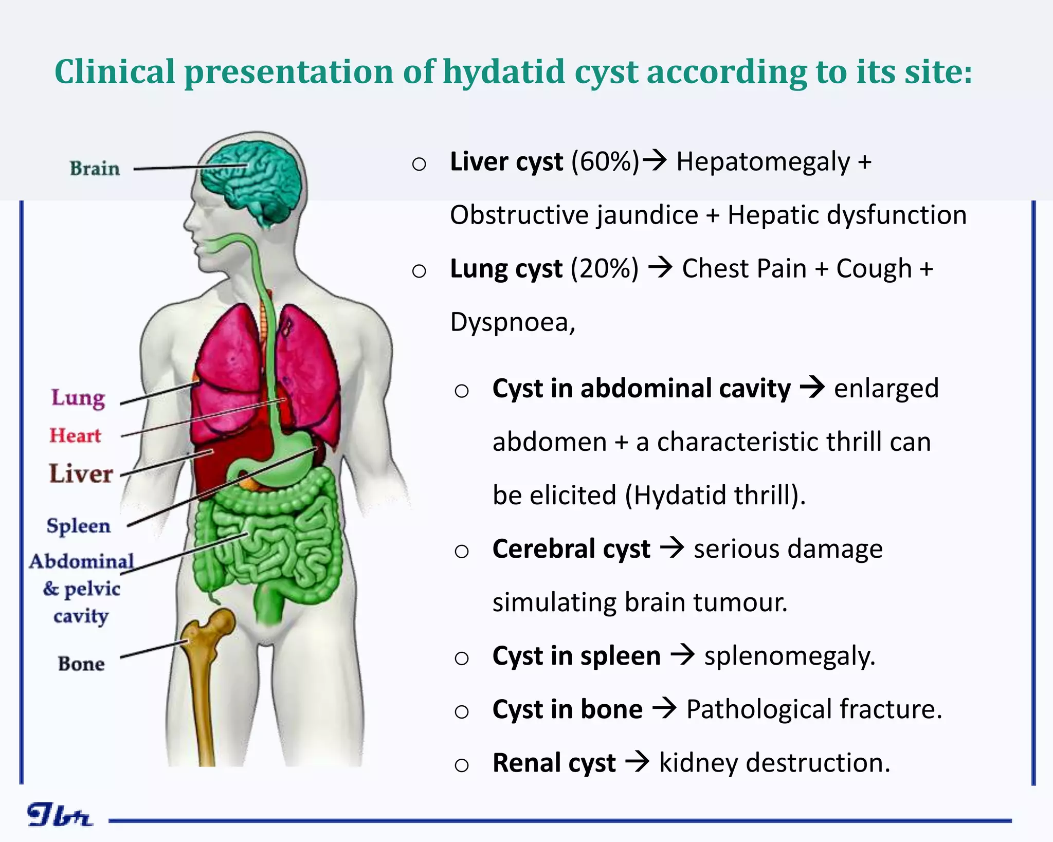 Hydatid cyst.pptx
