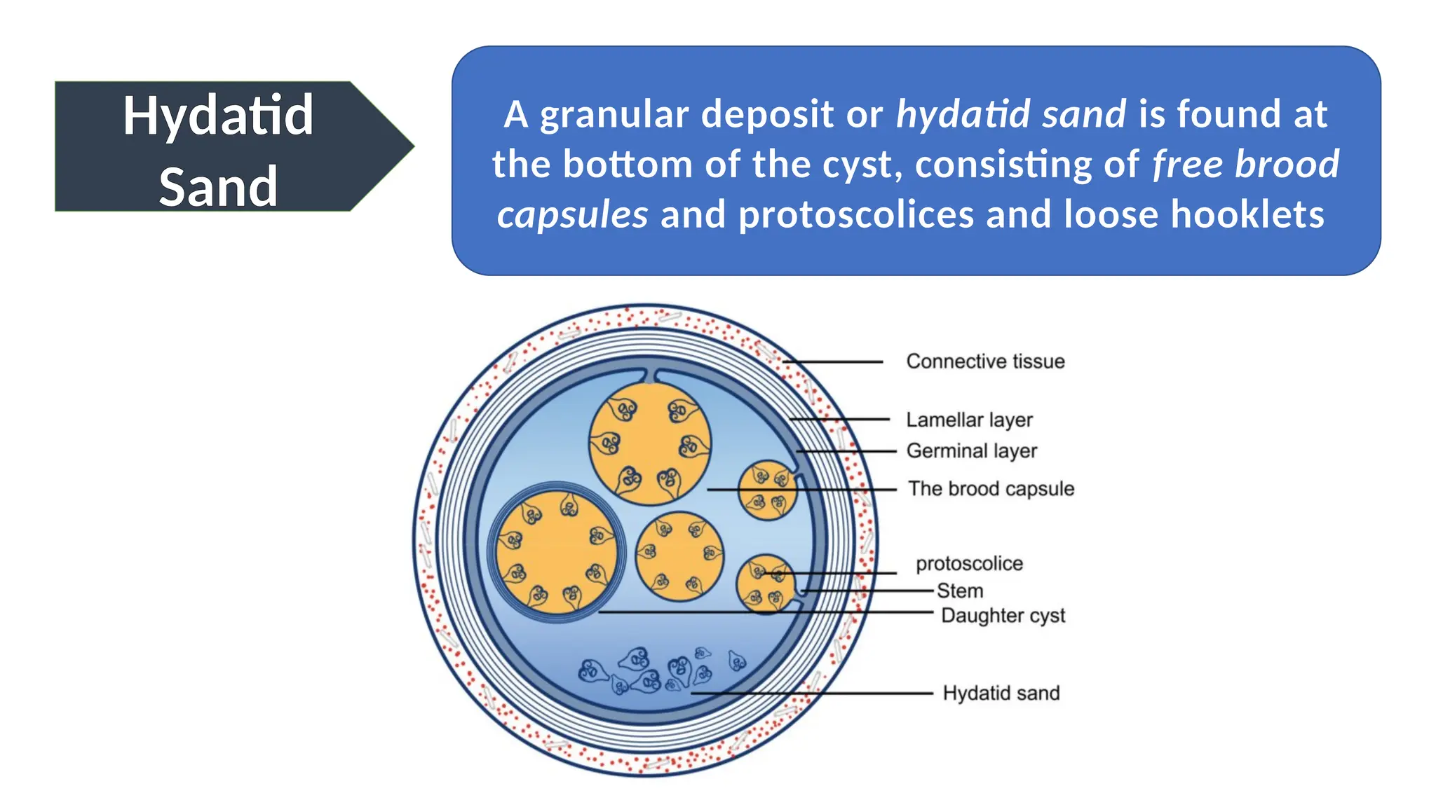 Hydatid Cyst: Pathogenesis, Clinical Manifestations, and Management ...