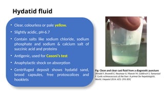 Hydatid Cyst: Pathogenesis, Clinical Manifestations, and Management ...