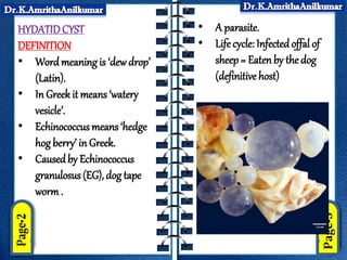 Hydatid cyst of liver by Dr.AmrithaAnilkumar | PPT