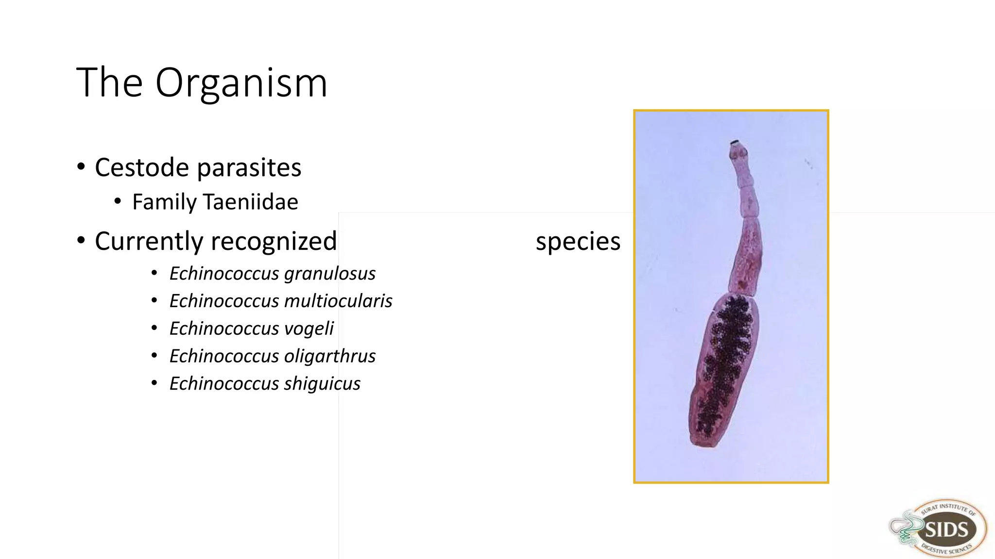 Hydatid cyst liver over view - Dr Keyur Bhatt | PPTX | Infectious Diseases | Diseases and Conditions
