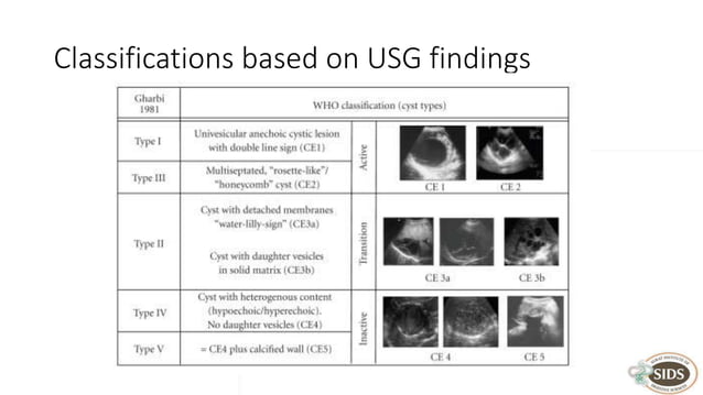 Hydatid Cyst Liver Over View Dr Keyur Bhatt Ppt