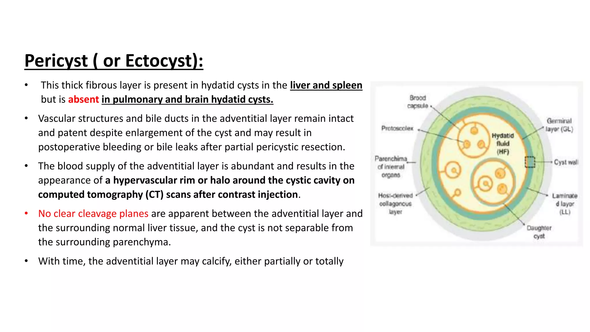 Hydatid cyst disease of the liver الدكتور طارق المنيزل | PPTX