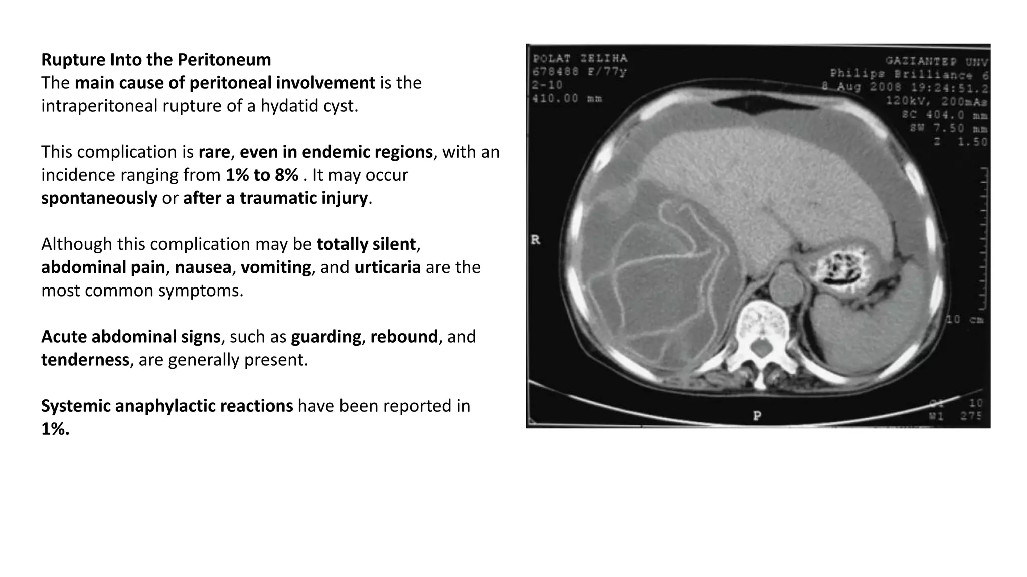 Hydatid cyst disease of the liver الدكتور طارق المنيزل | PPTX