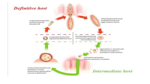 Hydatid cyst disease of the liver الدكتور طارق المنيزل | PPTX