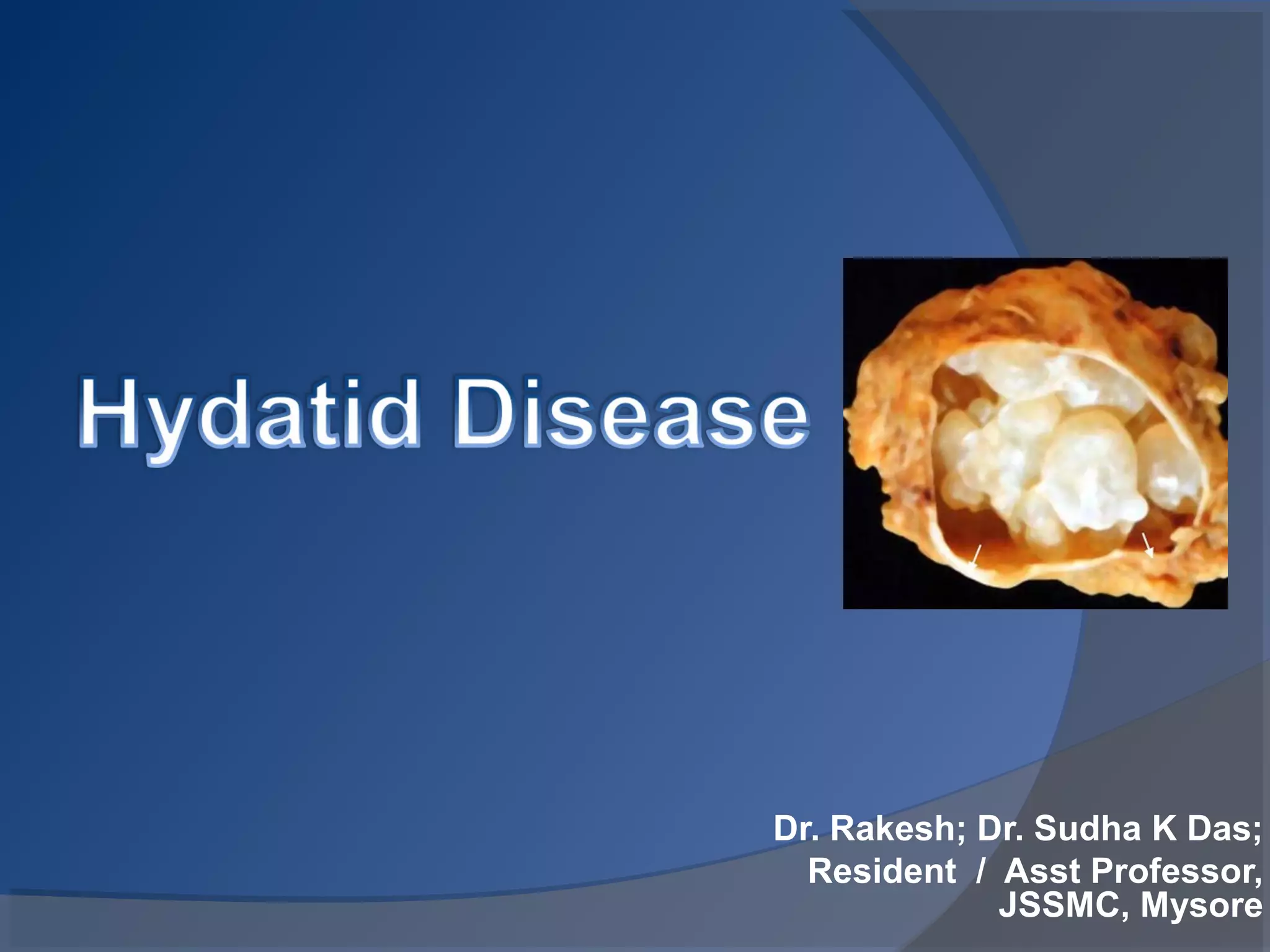 Hydatid disease | PPT
