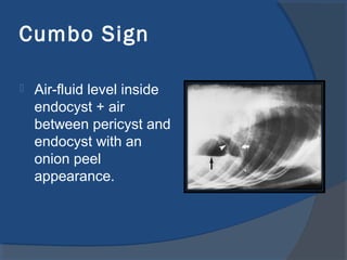 Hydatid disease | PPT