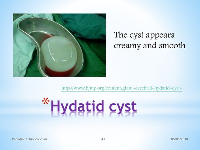 Hydatid disease | PPT