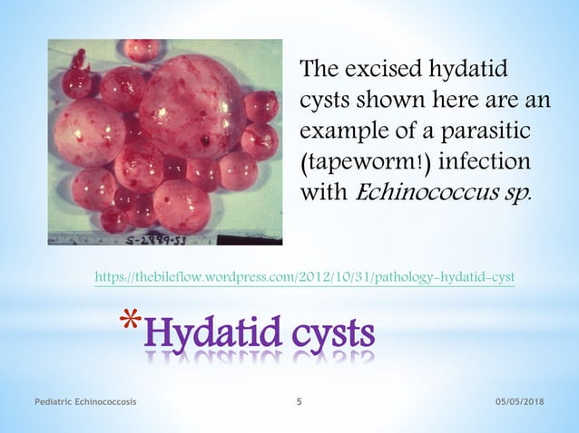 Hydatid disease | PPT