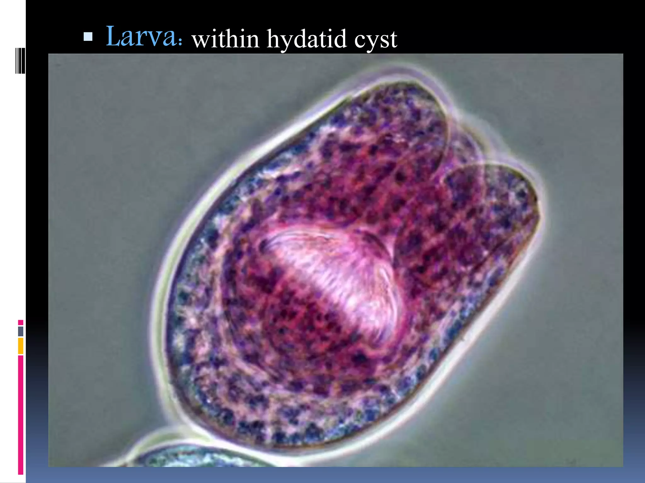 Hydatid disease of liver | PPTX | Lung and Respiratory Health ...