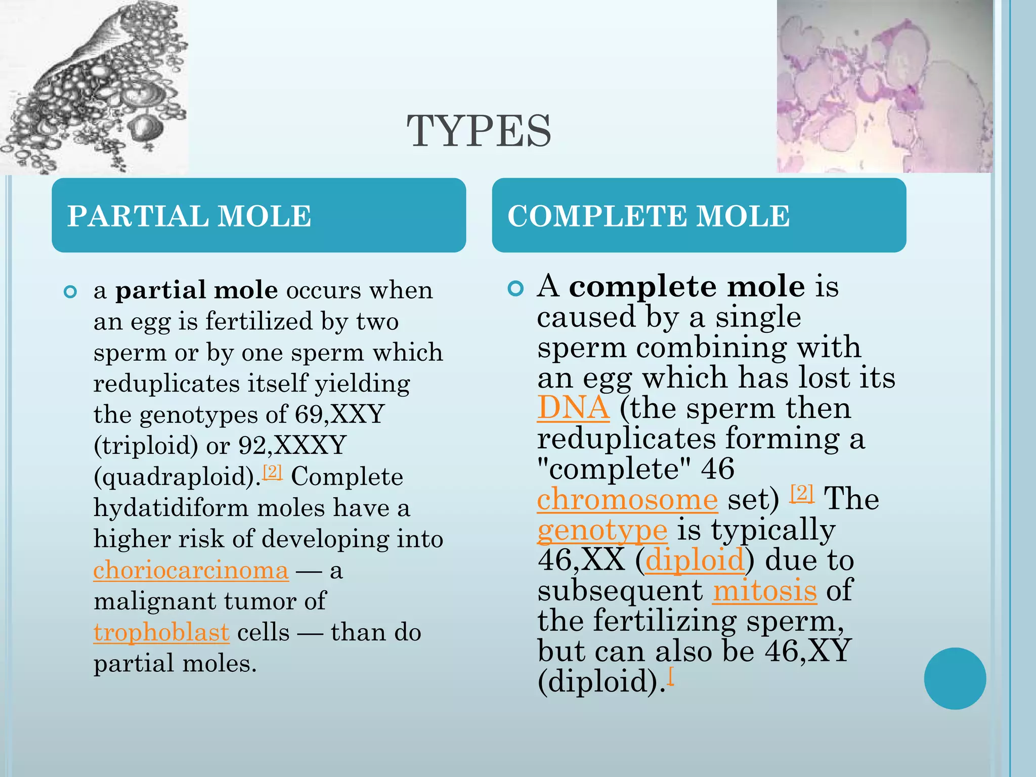 Hydatid form mole | PDF