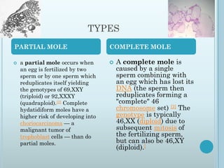 Hydatid form mole | PDF