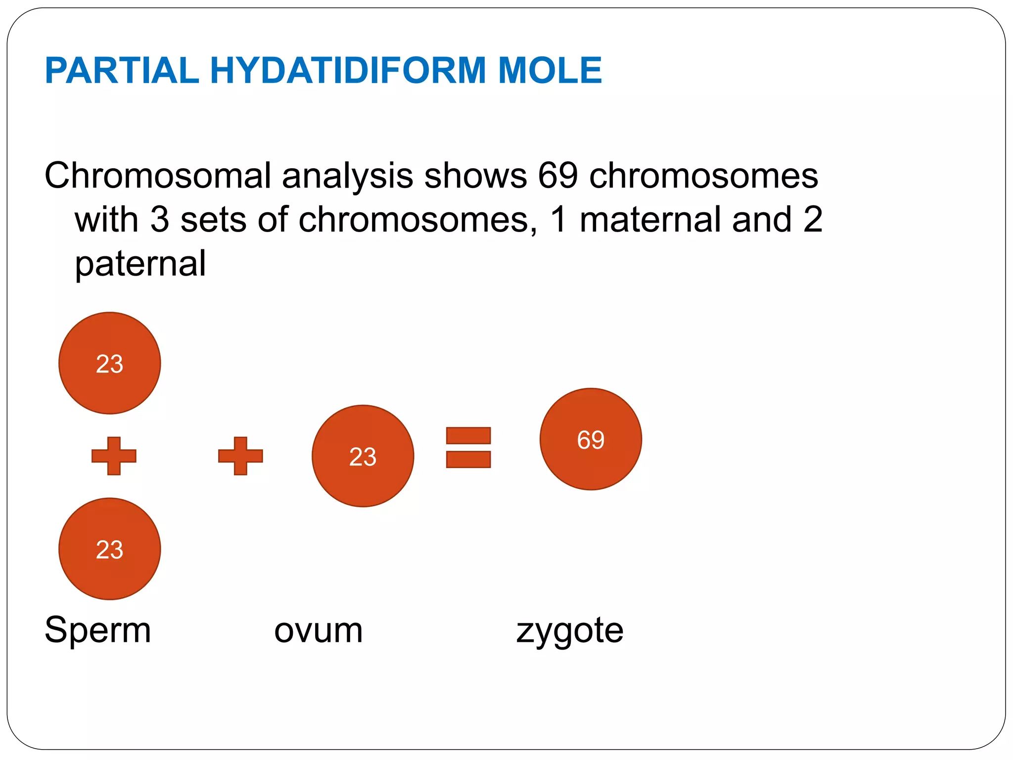 Hydatidiform mole | PPTX