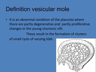 Hydatidiform mole | PPTX