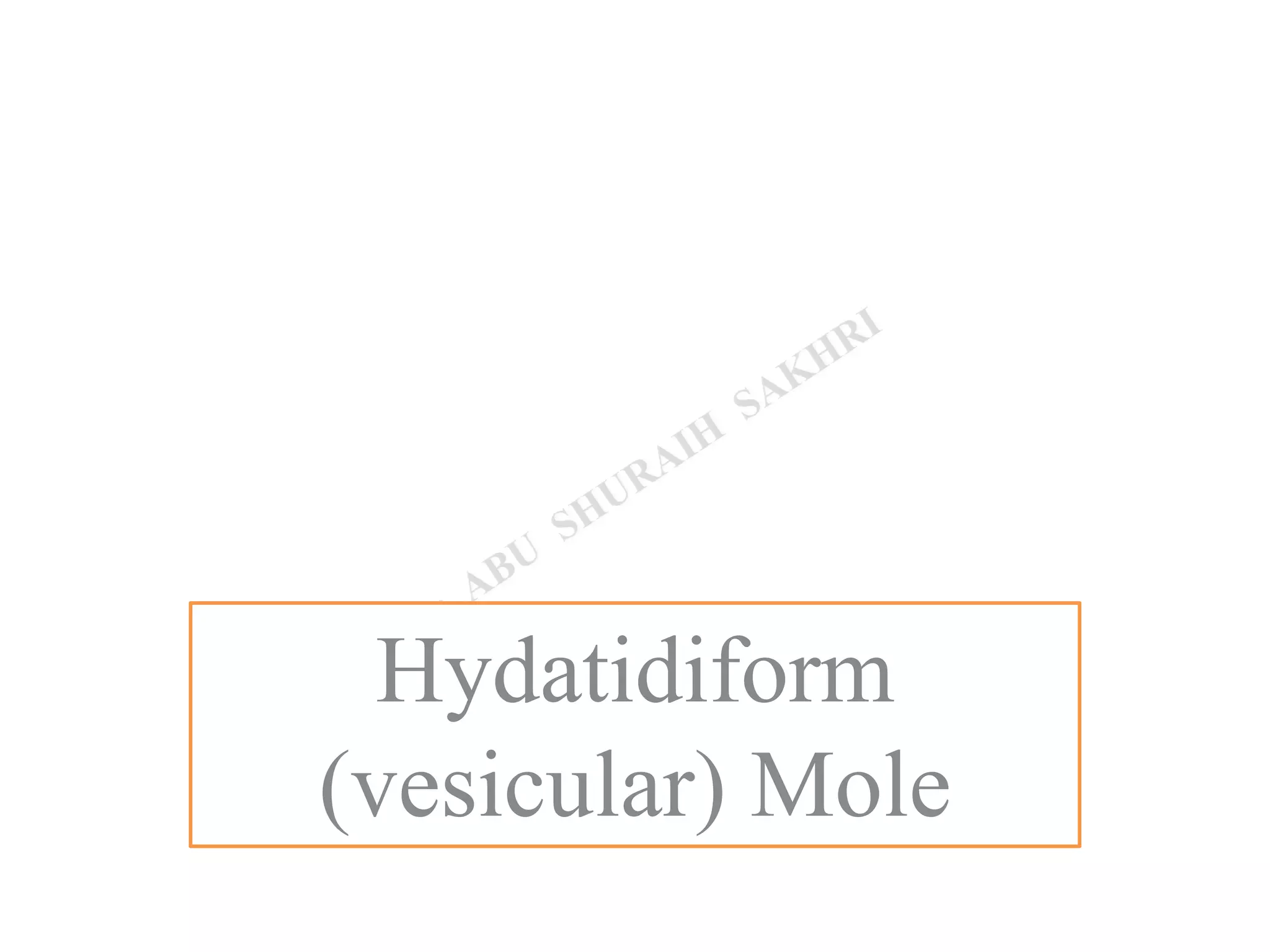 Hydatidiform mole/ VESICULAR MOLE | PPTX
