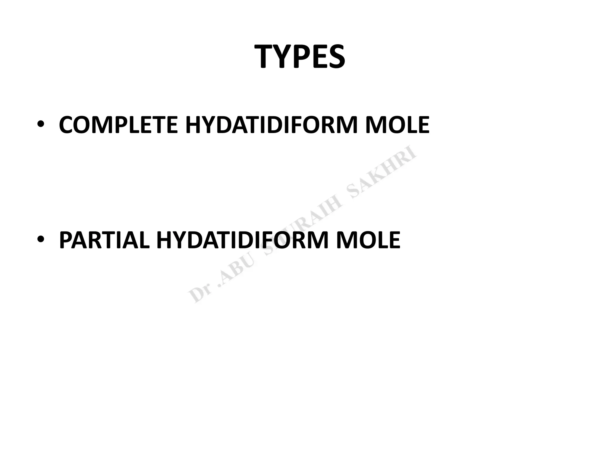 Hydatidiform mole/ VESICULAR MOLE | PPTX