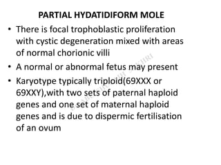 Hydatidiform mole/ VESICULAR MOLE | PPTX