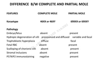 Hydatidiform mole/ VESICULAR MOLE | PPTX