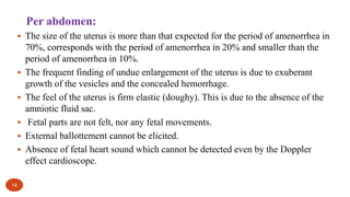 Hydatidiform mole | PPTX | Pregnancy | Reproductive Health