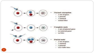 Hydatidiform mole | PPTX | Pregnancy | Reproductive Health