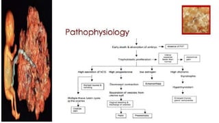 HYDATIDIFORM MOLE.pptx | Pregnancy | Reproductive Health