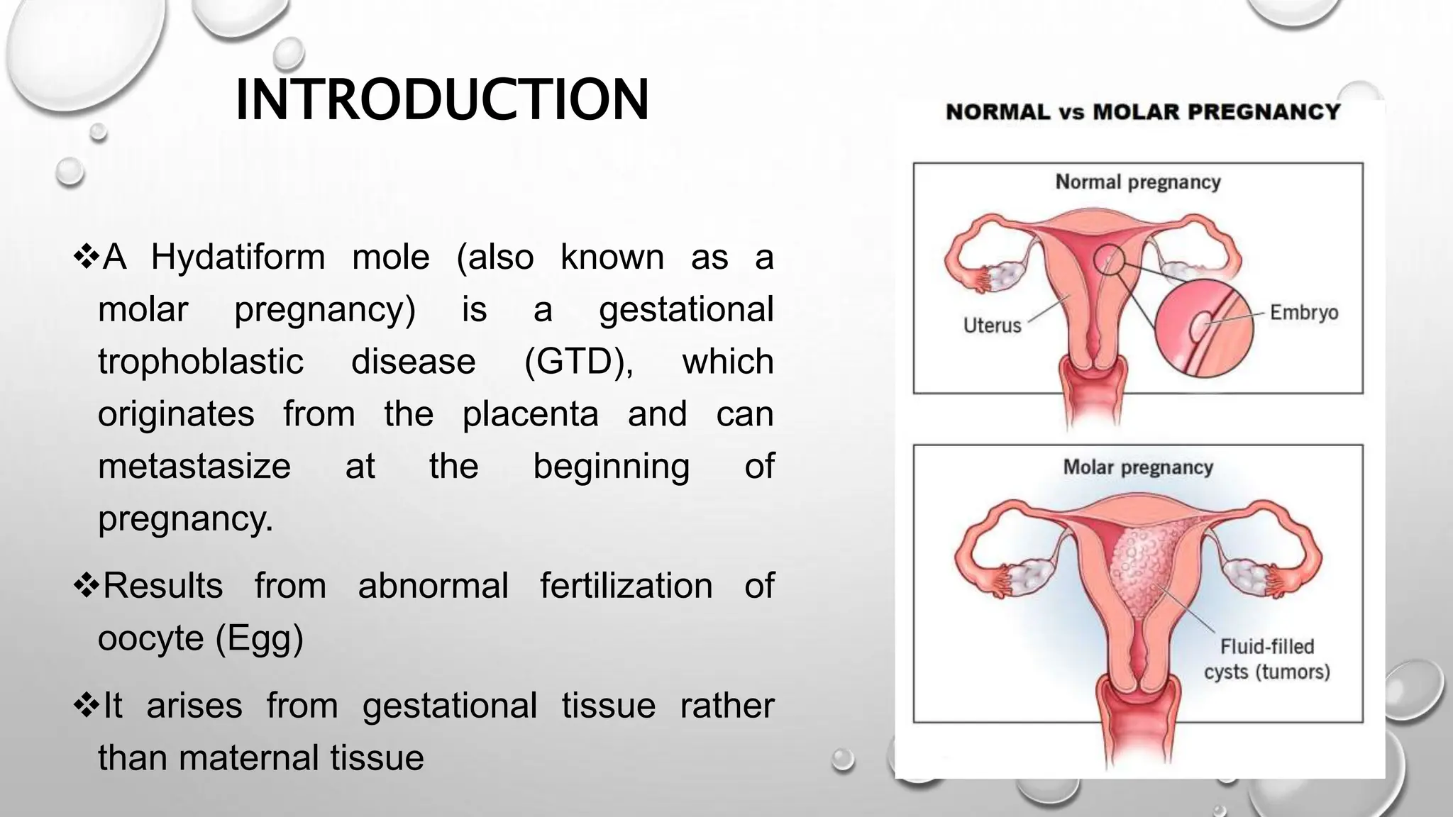 Hydatidiform Mole.pptx.pptx