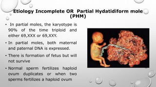 Hydatidiform Mole.pptx.pptx