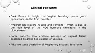 Hydatidiform Mole.pptx.pptx