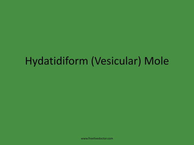 Hydatidiform (vesicular) mole | PPTX | Pregnancy | Reproductive Health