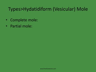 Hydatidiform (vesicular) mole | PPTX