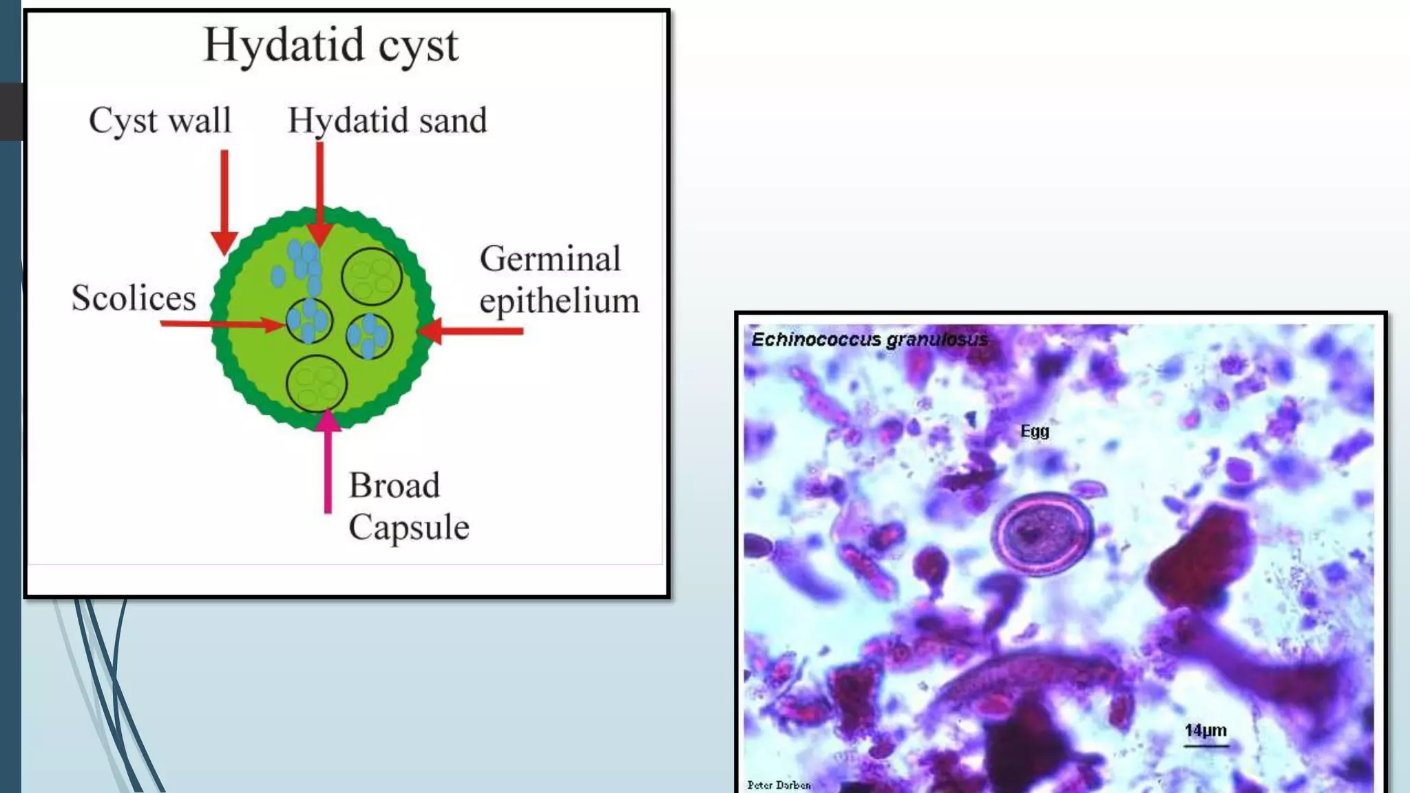 Hydatidosis- Echinococcus granulosus | PPT