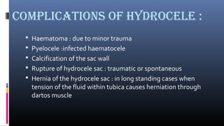 Hydrocele management | PPT