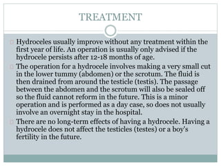 Hydrocele | PPTX
