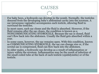 Hydrocele | PPTX
