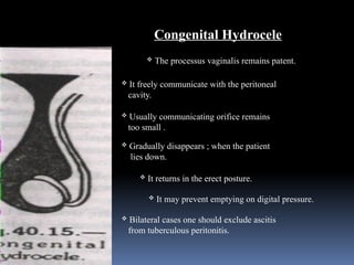 HYDROCELE , complications and its management | PPTX