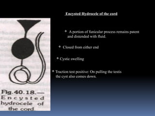 HYDROCELE , complications and its management | PPTX