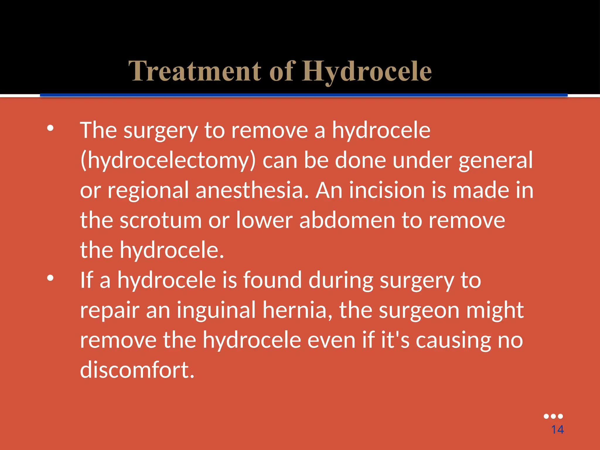 hydrocele mbbs topic new ppt uploded by dev | PPTX