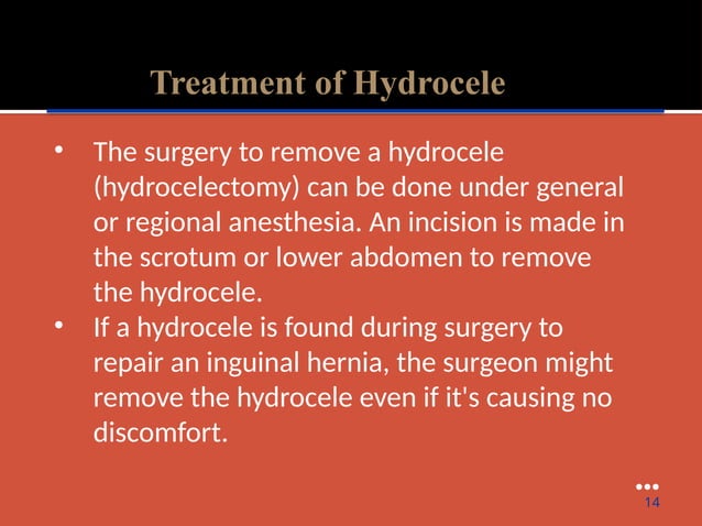 hydrocele mbbs topic new ppt uploded by dev | PPT
