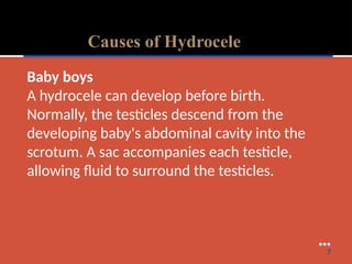 hydrocele mbbs topic new ppt uploded by dev | PPTX