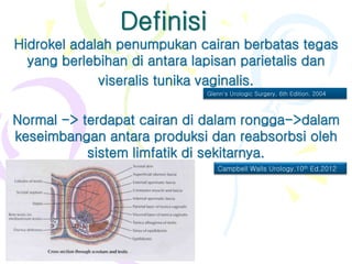 Hydrocele hidrokel anak optek aai | PPTX