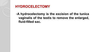 Hydrocelectomy | PPTX