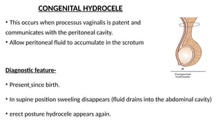 Hydrocele types and examination and management | PPTX