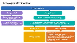 Hydrocele types and examination and management | PPTX