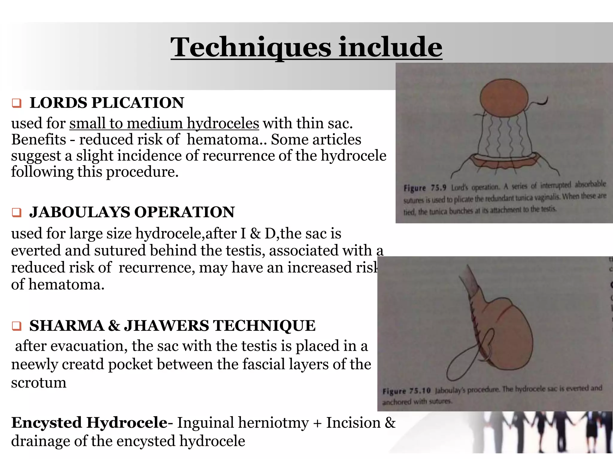 Hydrocele- All types & treatment options | PPTX