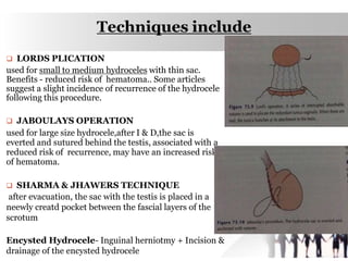 Hydrocele- All types & treatment options | PPTX