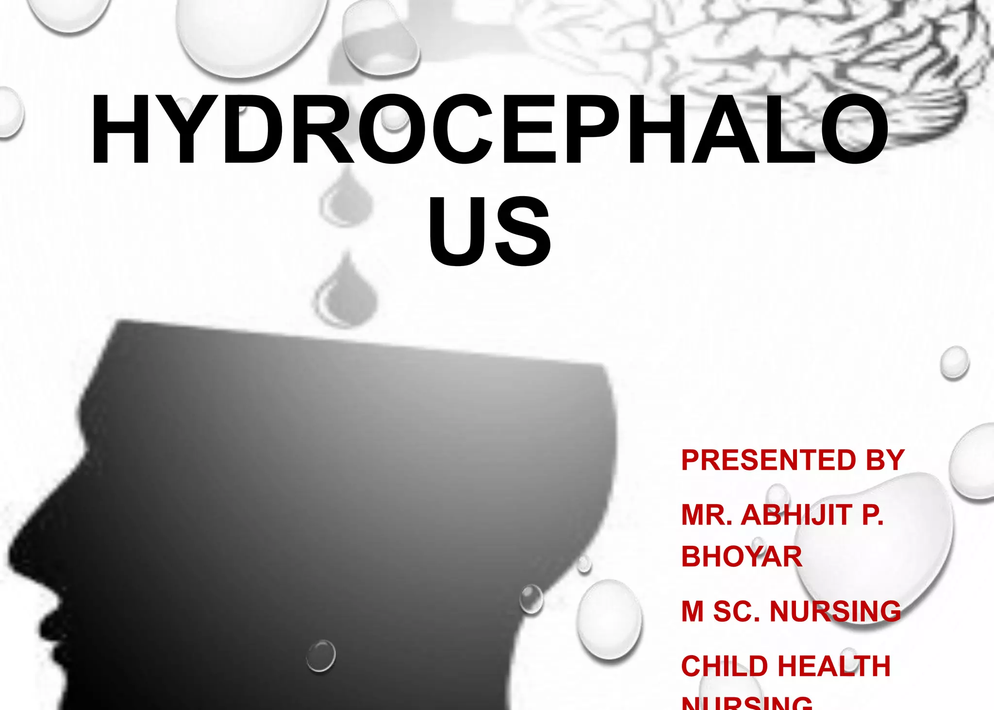 Hydrocephalous with nursing management | PPTX