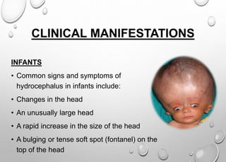 Hydrocephalous with nursing management | PPTX