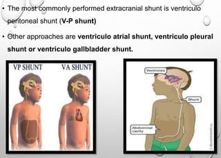 Hydrocephalous with nursing management | PPTX